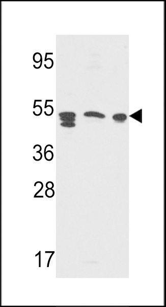 SAP Antibody - Cat. No. 62-882 | ProSci