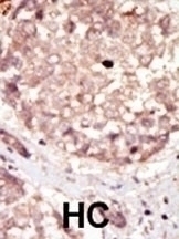 HIPK3 Antibody - Cat. No. 62-973 | ProSci
