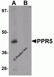 PRR5 Peptide - Cat. No. 6291P | ProSci