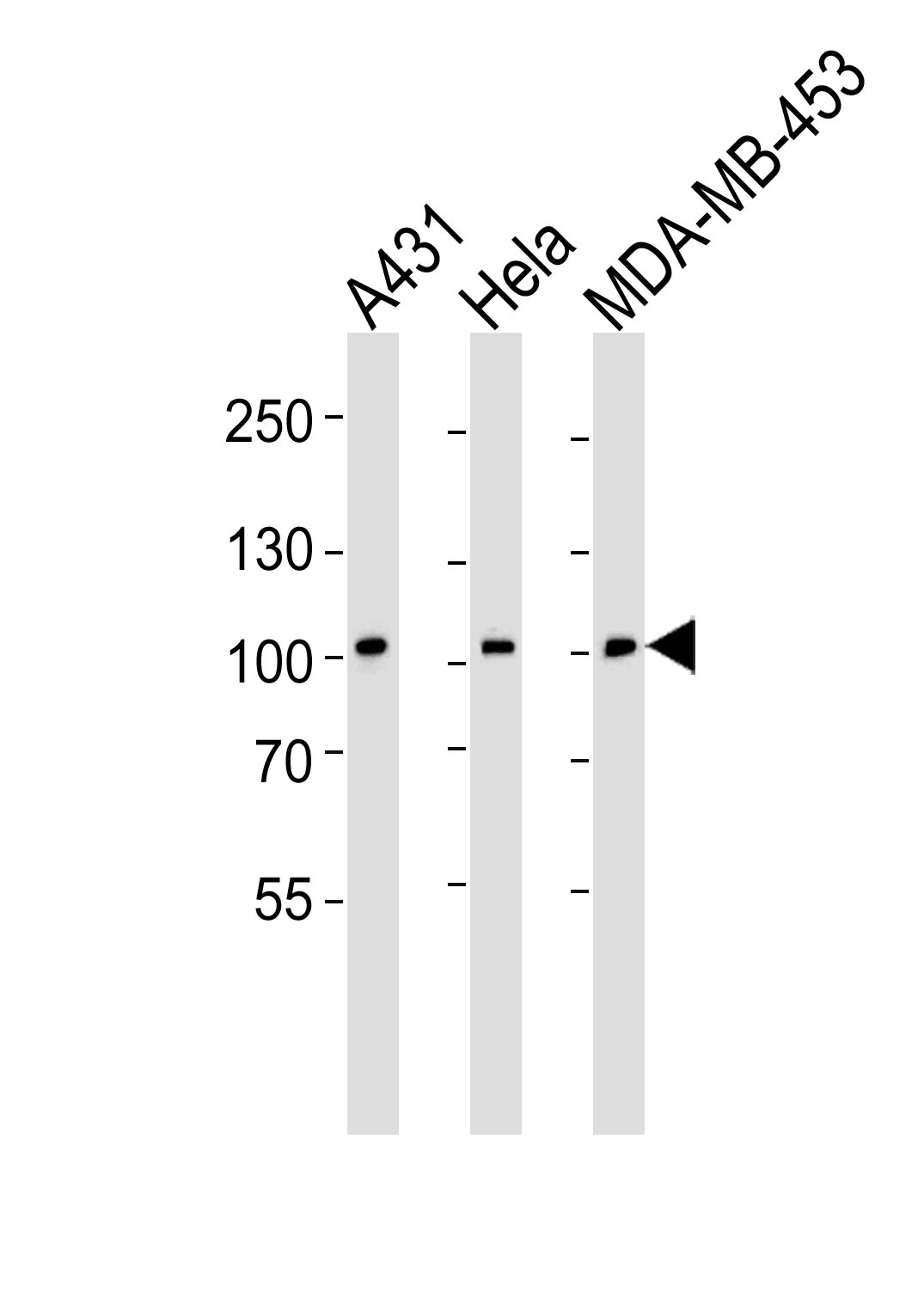 EphB1 Antibody - Cat. No. 63-054 | ProSci