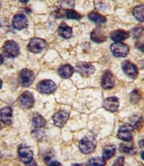 PDGFRA Antibody - Cat. No. 63-118 | ProSci