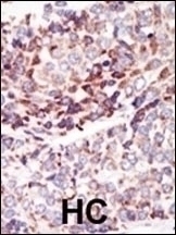 TEK Antibody - Cat. No. 63-140 | ProSci
