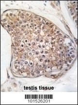 TEK Antibody - Cat. No. 63-140 | ProSci