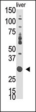 DOK5 Antibody - Cat. No. 63-150 | ProSci
