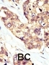 DOK5 Antibody - Cat. No. 63-150 | ProSci