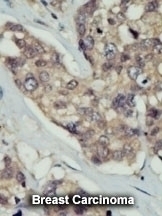 DOK5 Antibody - Cat. No. 63-151 | ProSci