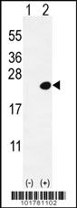 DOK5 Antibody - Cat. No. 63-151 | ProSci