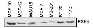 RSK4 Antibody - Cat. No. 63-301 | ProSci