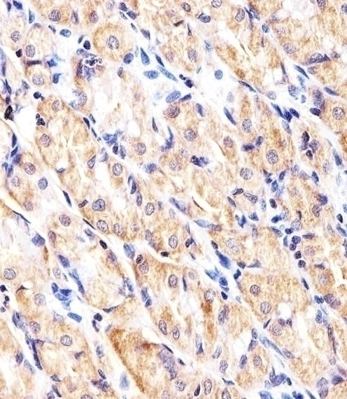 HK2 Antibody - Cat. No. 63-423 | ProSci