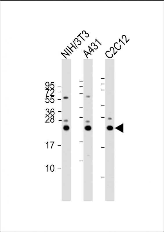 RAB7 Antibody - Cat. No. 63-577 | ProSci