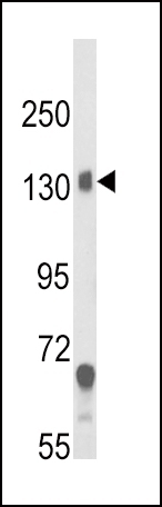 CACNA2D1 Antibody - Cat. No. 63-598 | ProSci