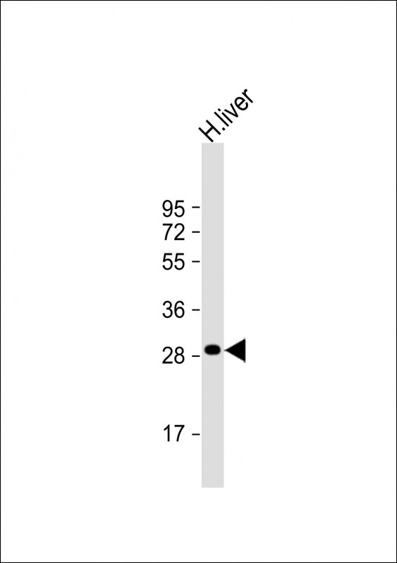 QDPR Antibody - Cat. No. 63-664 | ProSci