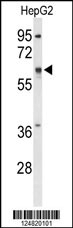 ATLA2 Antibody - Cat. No. 63-912 | ProSci