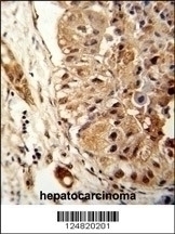 ATLA2 Antibody - Cat. No. 63-912 | ProSci