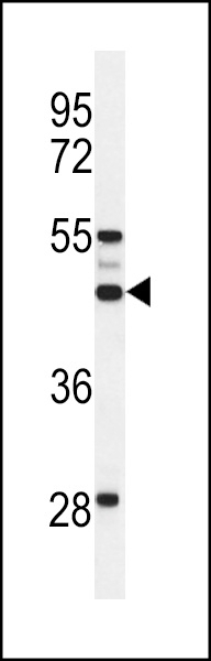 OST alpha Antibody - Cat. No. 64-141 | ProSci
