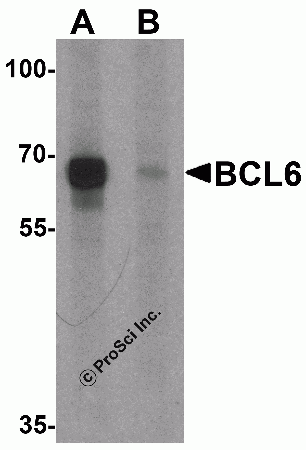 BCL6 Peptide - Cat. No. 6985P | ProSci