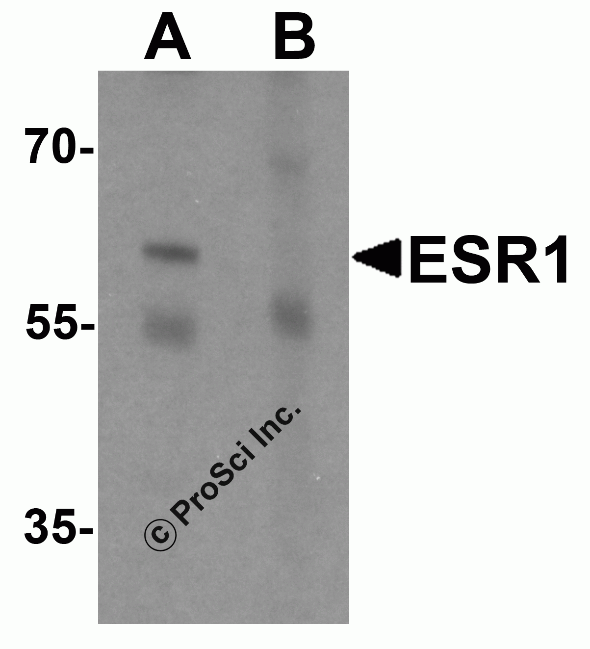 ESR1 Peptide - Cat. No. 7437P | ProSci