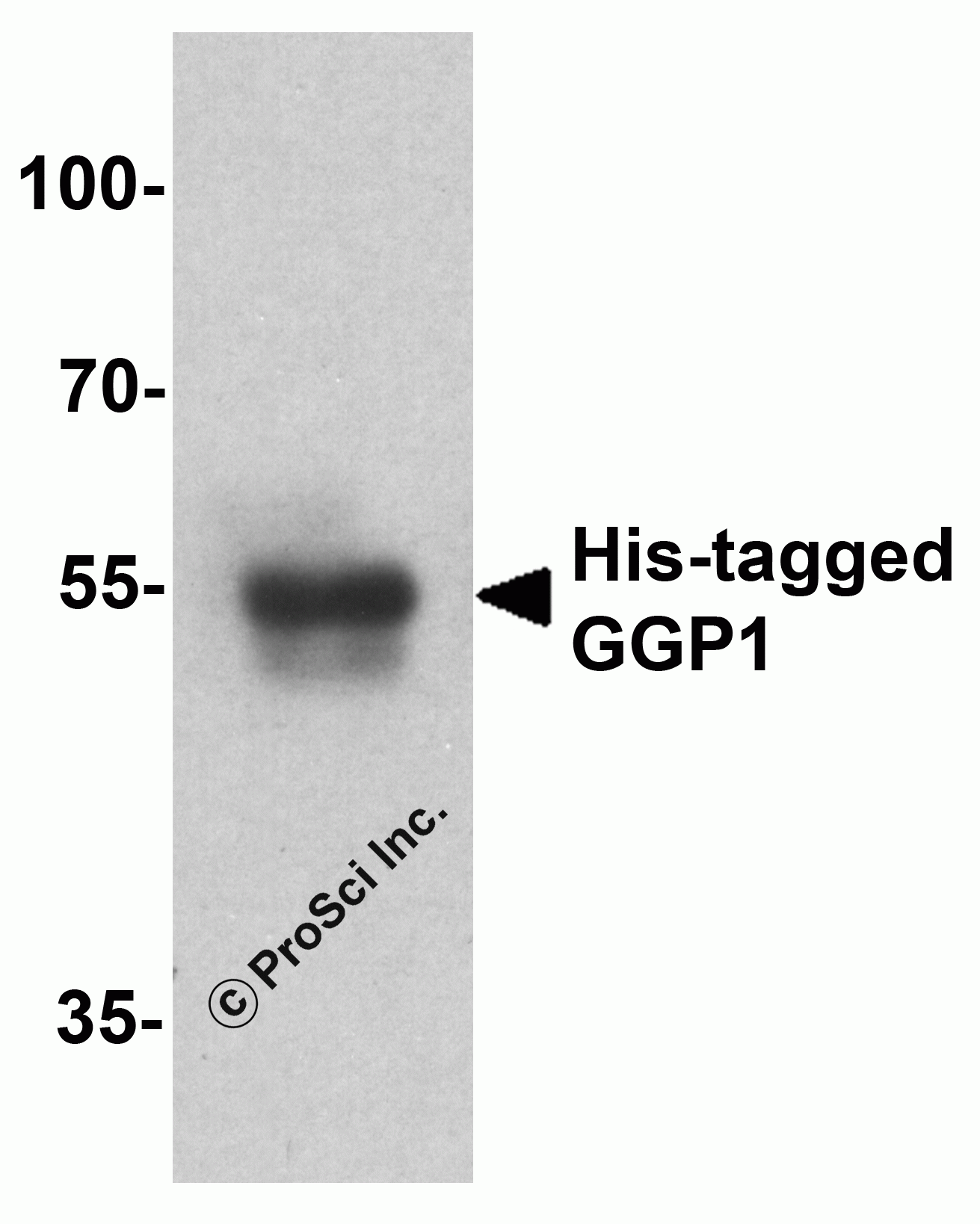 His Tag Antibody | Antibody Western Blot | ProSci Incorporated