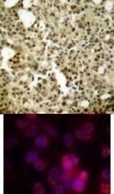 PKCdelta (Ab 645) Antibody - Cat. No. 79-401 | ProSci