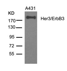 Her3 / ErbB3 (Ab 1328) Antibody - Cat. No. 79-420 | ProSci