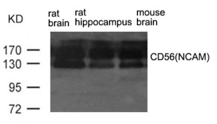 CD56 (NCAM) Antibody - Cat. No. 79-666 | ProSci