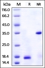ALCAM Recombinant Protein - Cat. No. 96-124 | ProSci