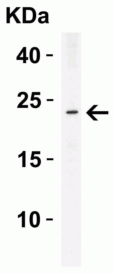 ASC Antibody - Cat. No. 2287 | ProSci