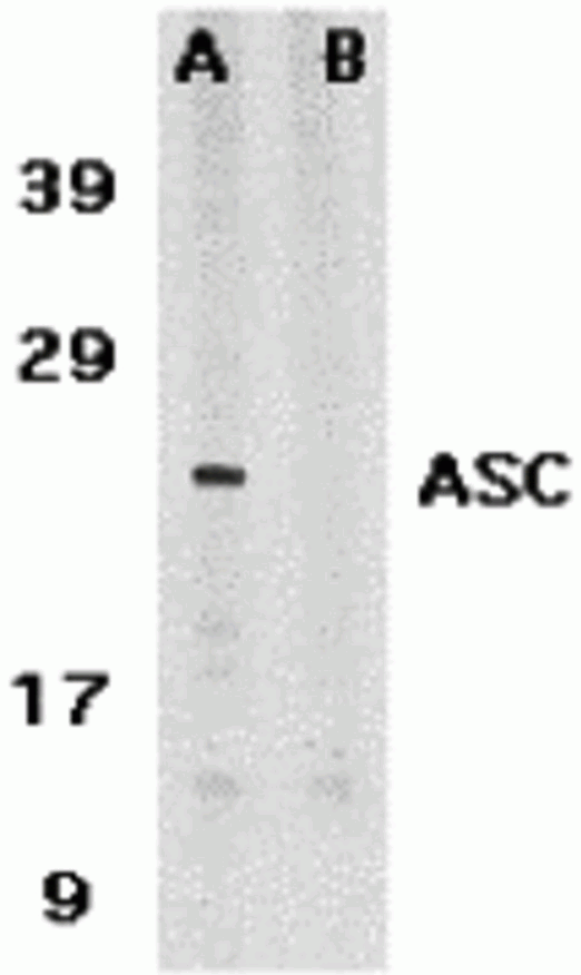 ASC Antibody - Cat. No. 2287 | ProSci