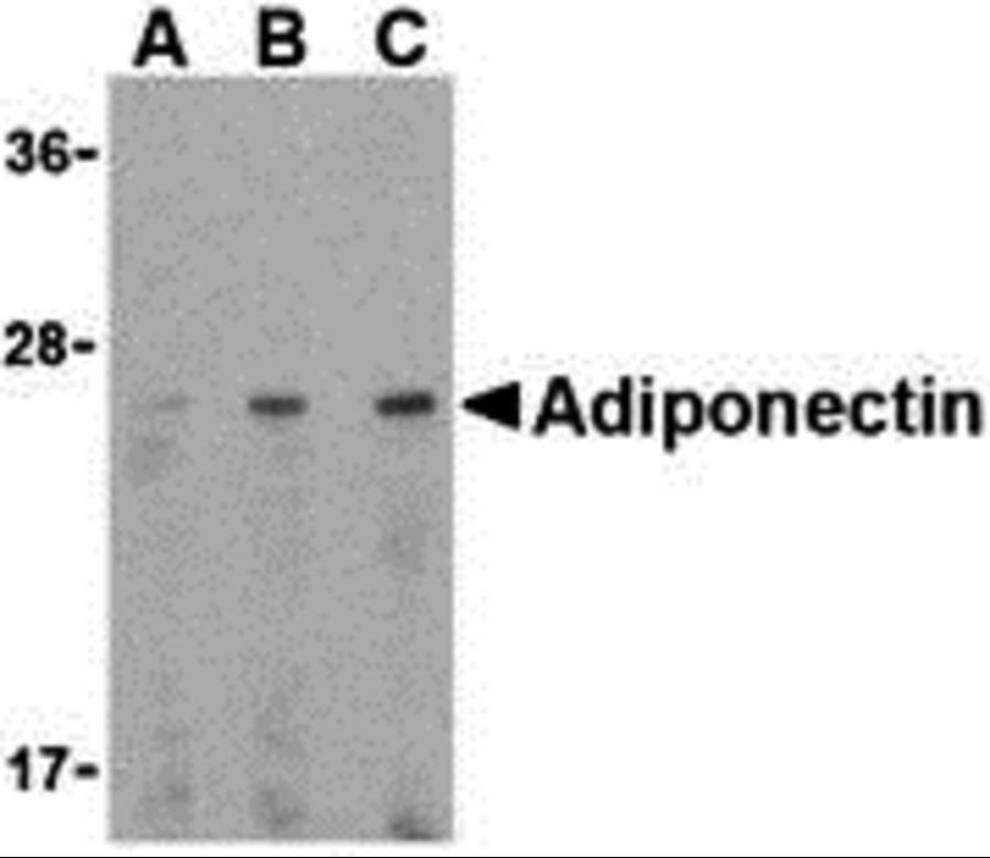 Adipokines: Adiponectin and CTRPs 1-7 Detection Set - Cat. No. PSI-1804 | ProSci