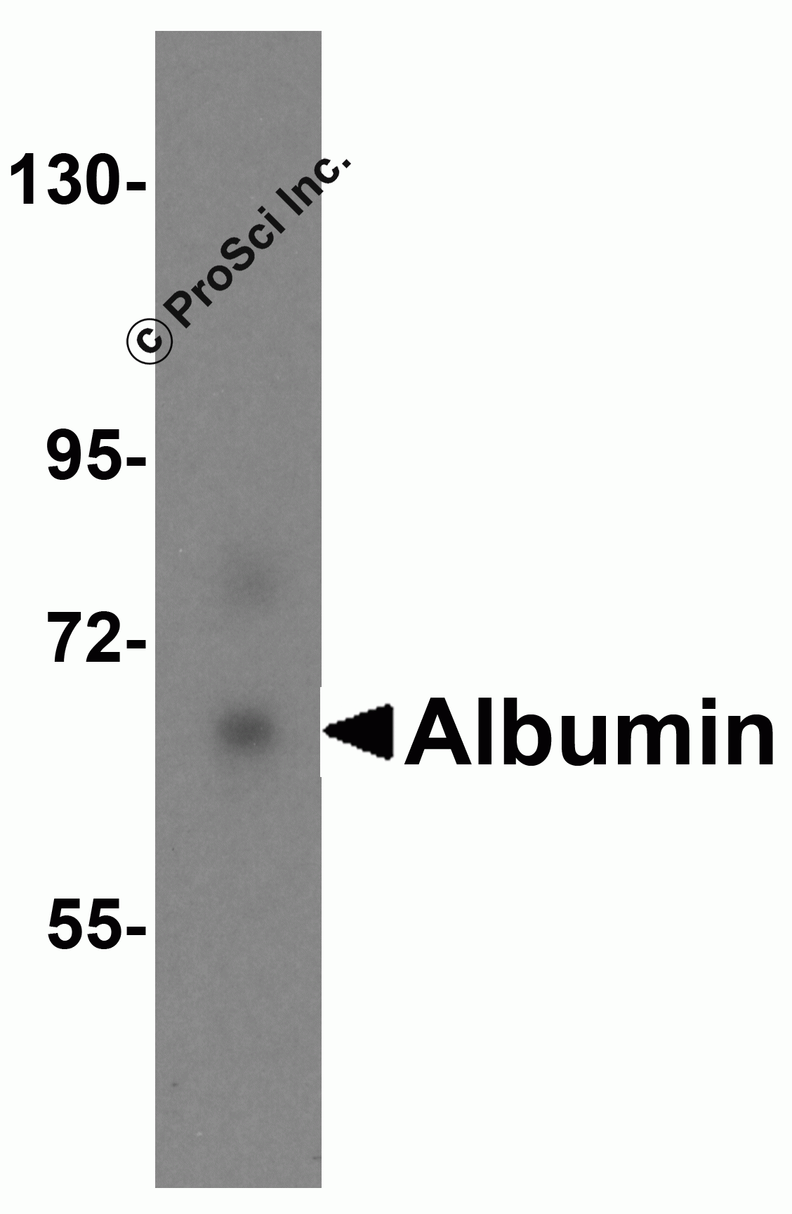 Albumin Antibody - Cat. No. 5159 | ProSci