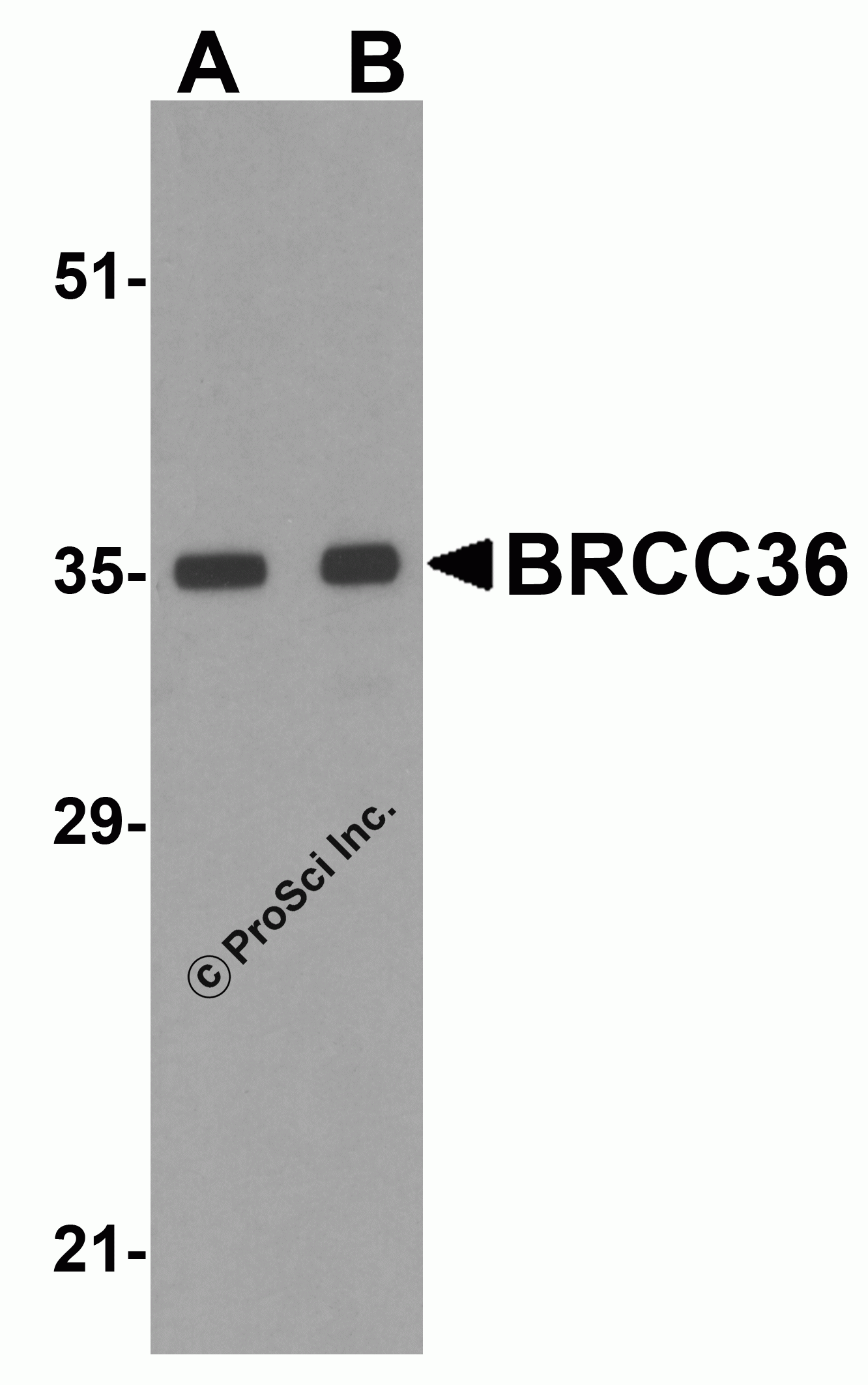 BRCC36 Antibody - Cat. No. 4331 | ProSci