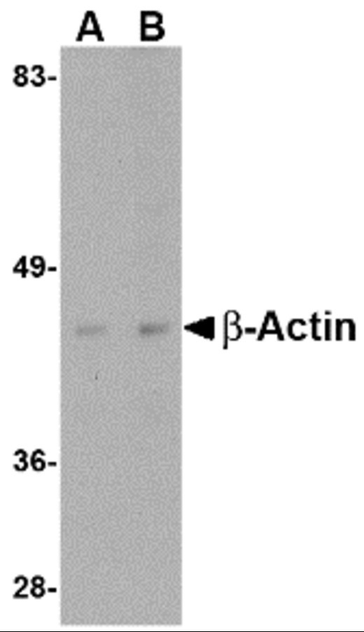 Beta-actin Antibody - Cat. No. 5005 | ProSci