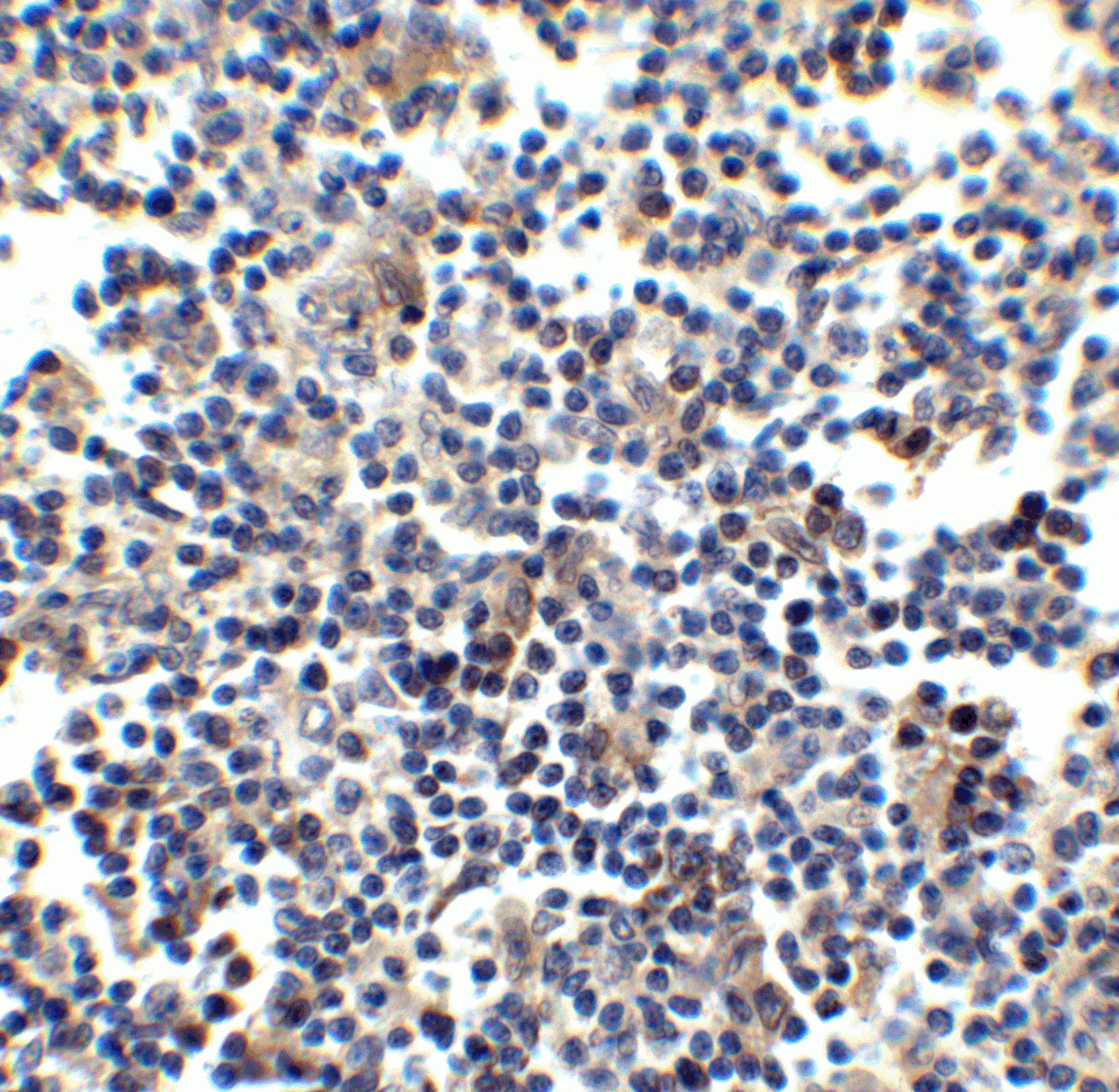 CCR5 Antibody - Cat. No. 1112 | ProSci