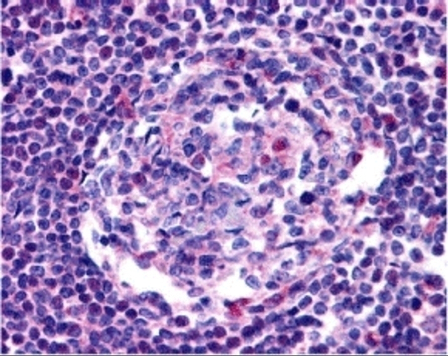 CCR5 Antibody - Cat. No. 1112 | ProSci