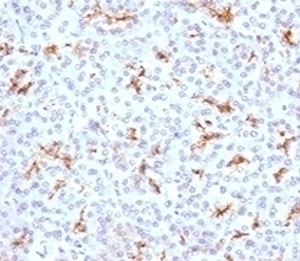 CFTR Antibody [CFTR1-1] - Cat. No. 34-037 | ProSci