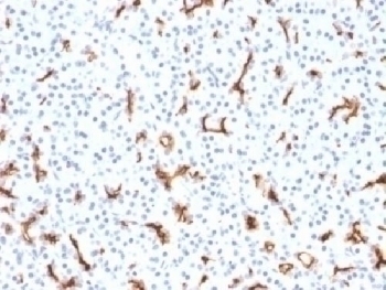 CFTR Antibody [CFTR/1785] - Cat. No. 33-786 | ProSci