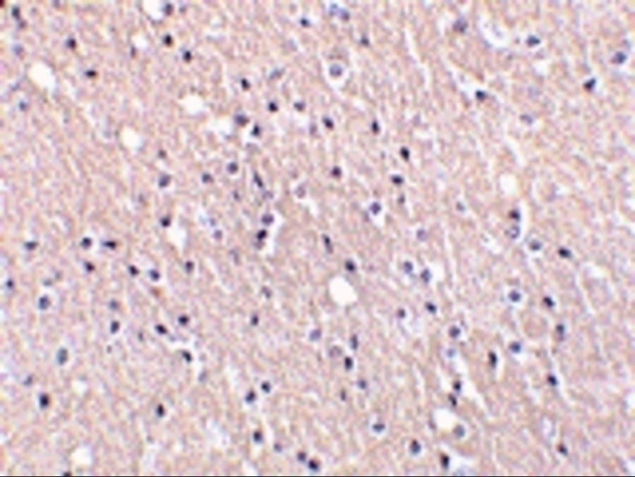 CIDE-A Antibody - Cat. No. 2085 | ProSci