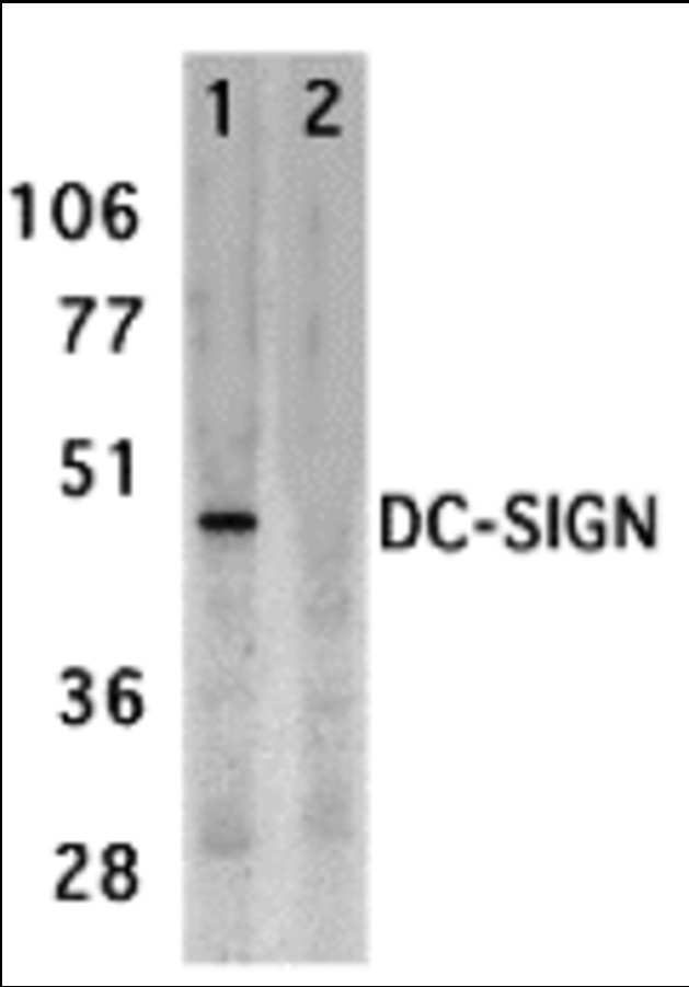 DC-SIGN Antibody - Cat. No. 2349 | ProSci