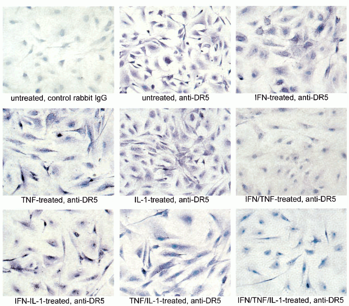 DR5 Antibody - Cat. No. 2019 | ProSci