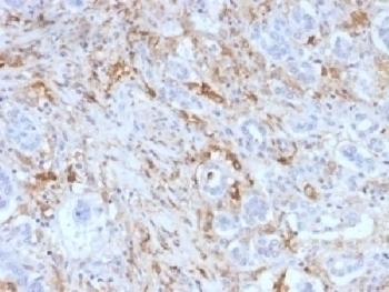 FTL1 Antibody [FTL/1388] - Cat. No. 33-712 | ProSci