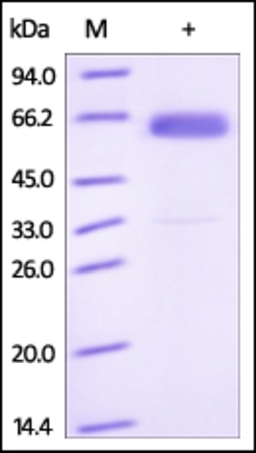 Frizzled 4 Recombinant Protein - Cat. No. 96-333 | ProSci