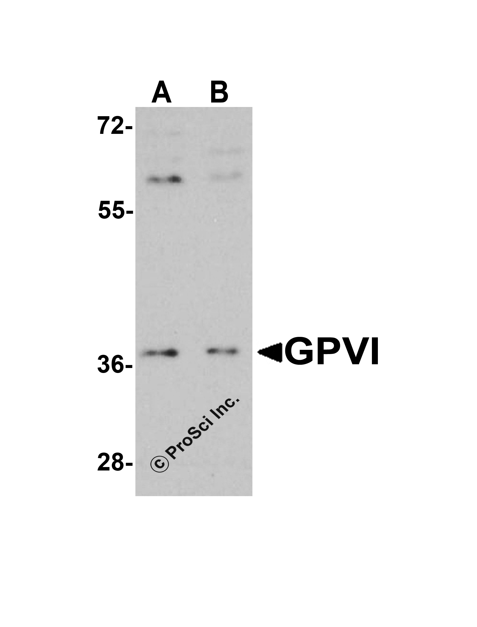GPVI Antibody - Cat. No. 4769 | ProSci