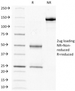 HCG-beta Antibody [HCGb/211] - Cat. No. 33-269 | ProSci