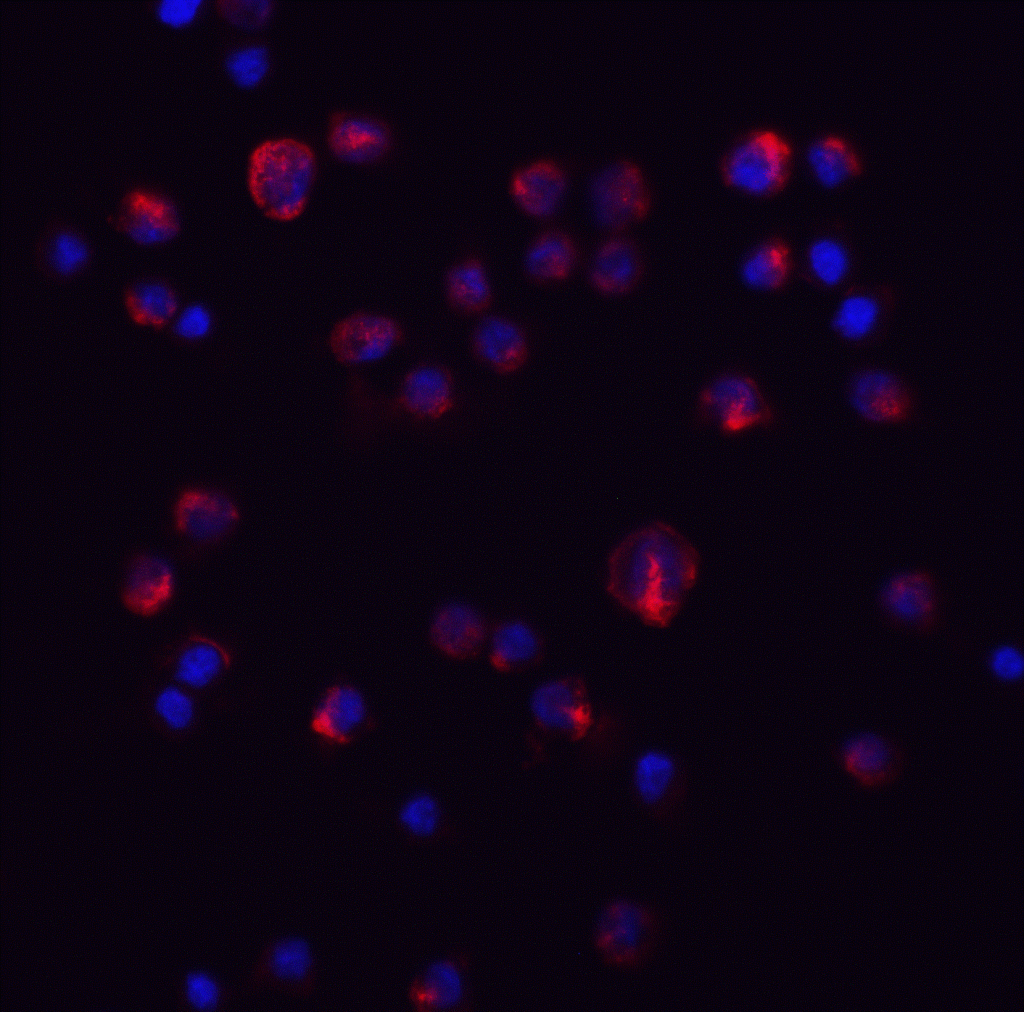IL-11 Antibody - Cat. No. 8453 | ProSci