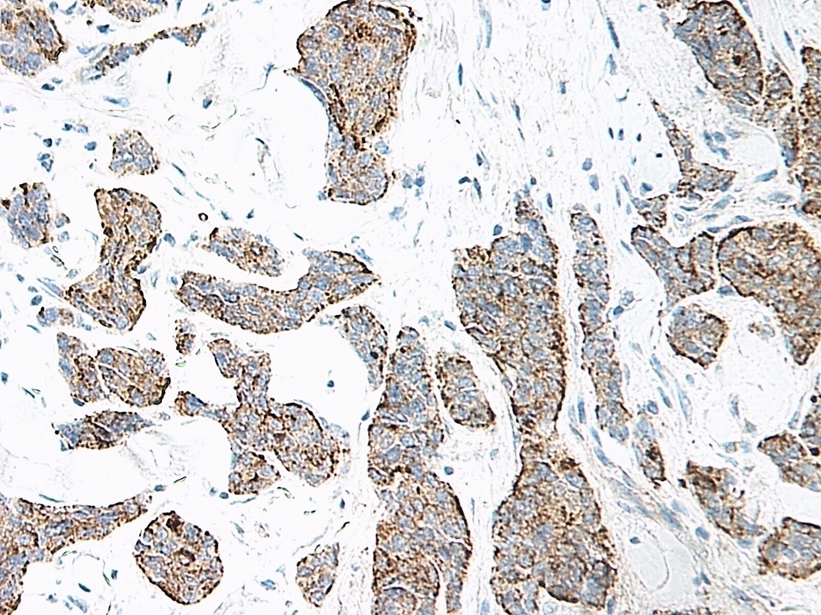 IL-17 Antibody - Cat. No. XP-5172 | ProSci