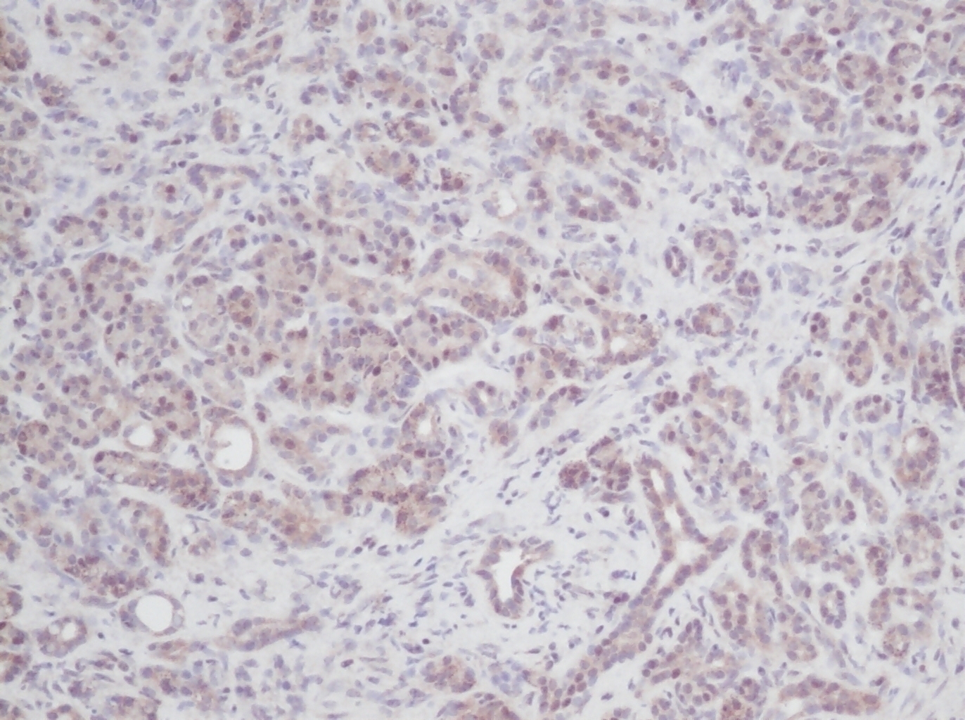 IL-2 Antibody - Cat. No. XP-5181 | ProSci