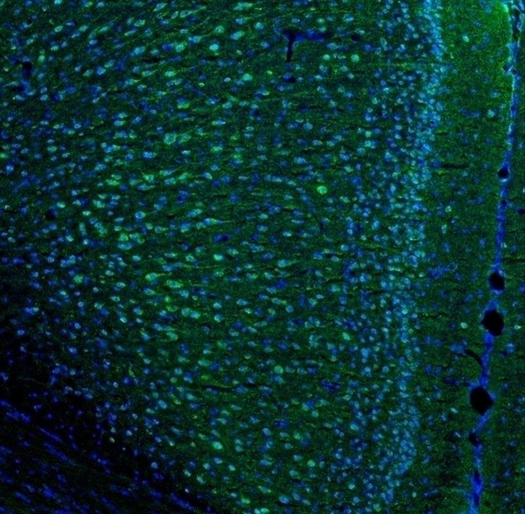 IL-6 Antibody - Cat. No. XP-5194 | ProSci
