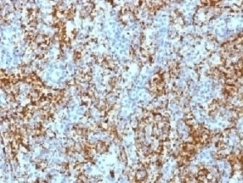 Integrin beta 3 Antibody [ITGB3/1713] - Cat. No. 33-635 | ProSci