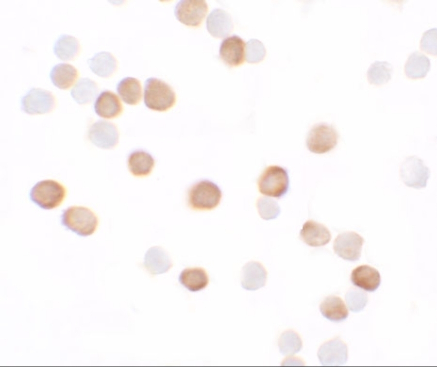 KREMEN2 Antibody - Cat. No. 7263 | ProSci