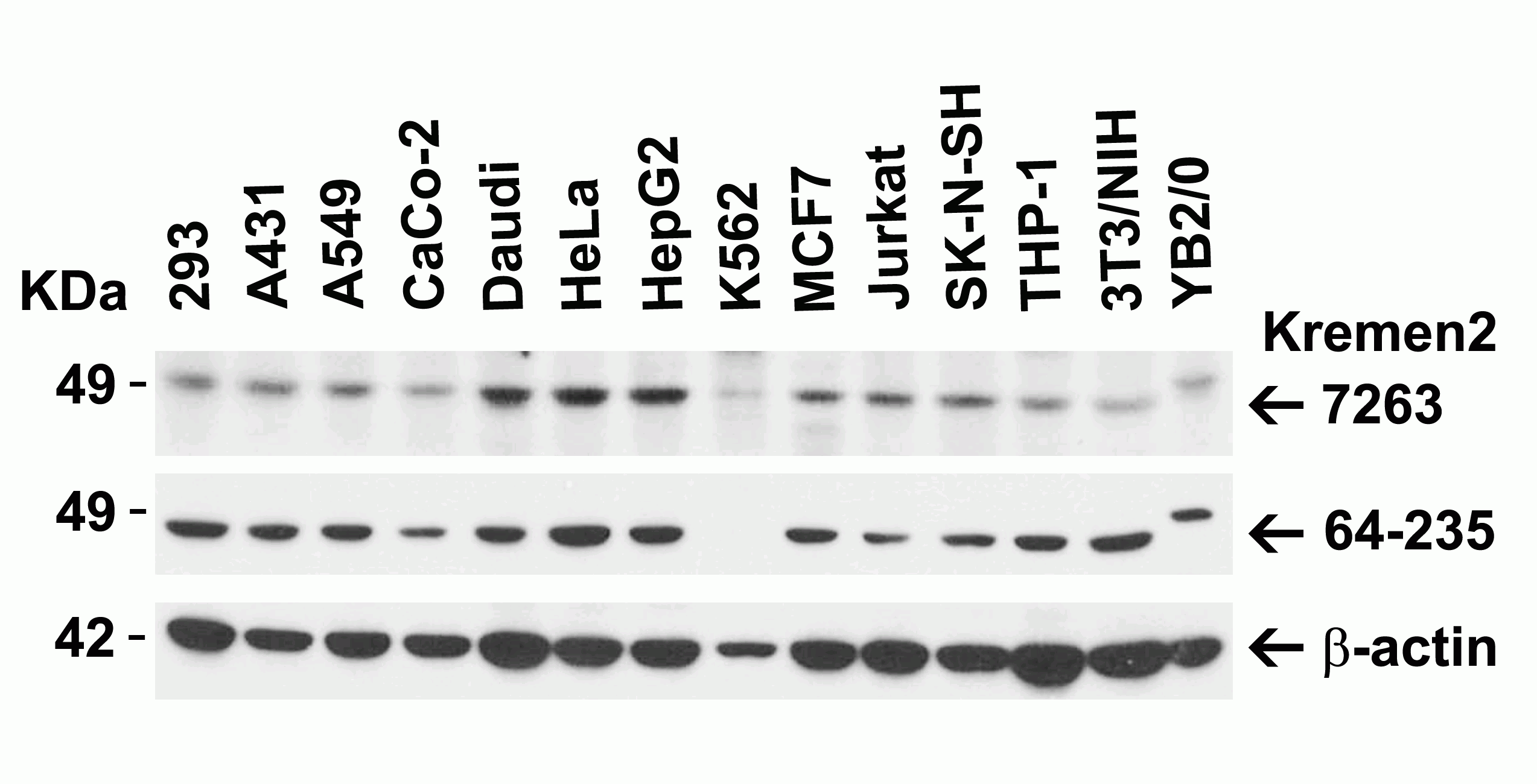 KREMEN2 Antibody - Cat. No. 7263 | ProSci